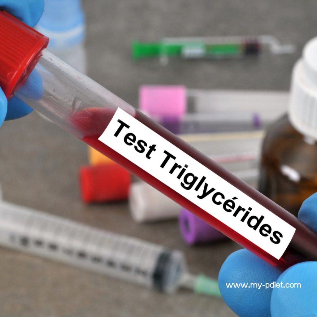 ¿Que es la hipertrigliceridemia? - My-PDiet.com - Nutrición